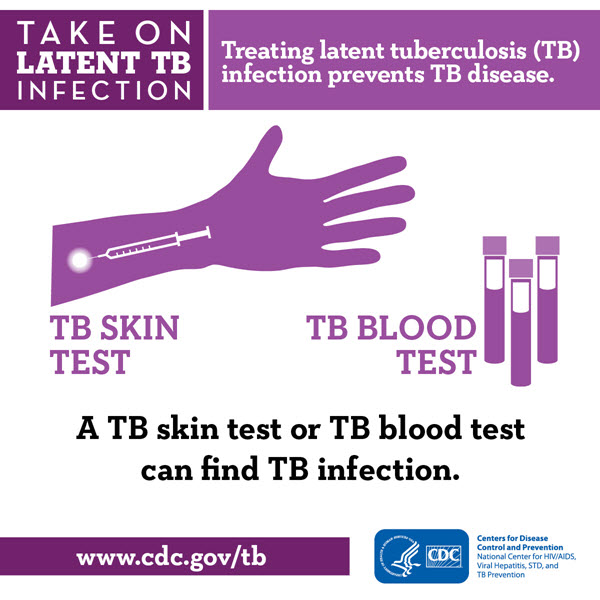 Tuberculosis (TB) | Clinton County Health Department | Clinton County ...